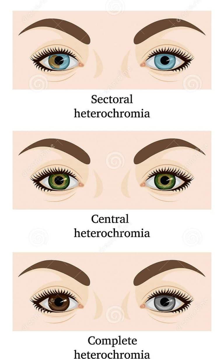 Hängt die Augenfarbe hauptsächlich von der Genetik ab?